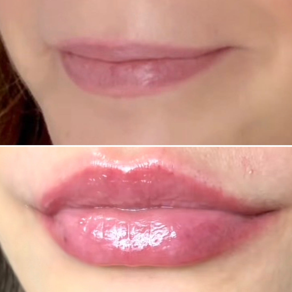 Lip Boosting Kit – GLOSSY